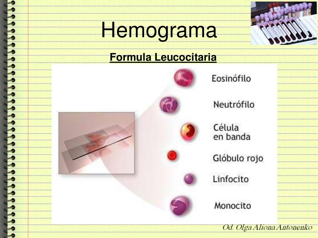 Hemograma Completo Y Valores Normales
