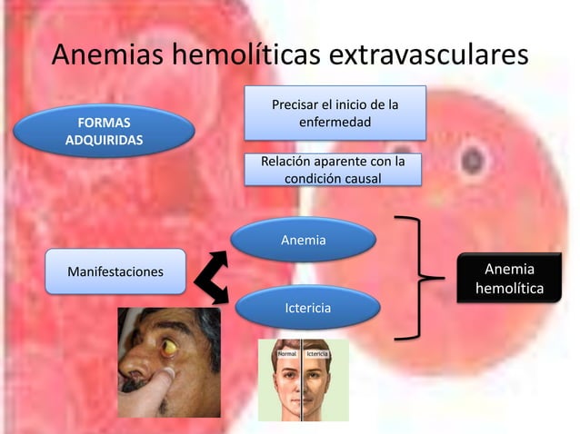 Hemolisis | PPTX | Blood Disorders | Diseases and Conditions