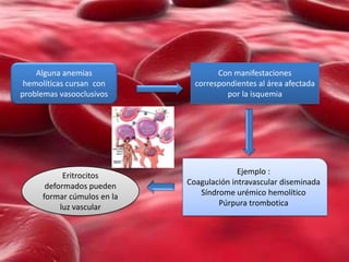 Hemolisis | PPTX