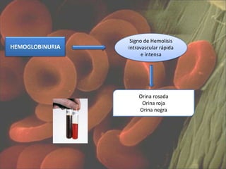 Hemolisis | PPTX