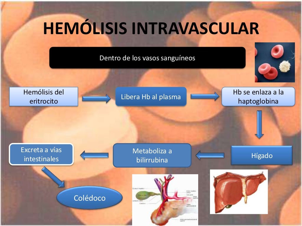 Hemolisis