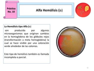 Hemolisis y pigmentos oky 2020 mip133.ppt
