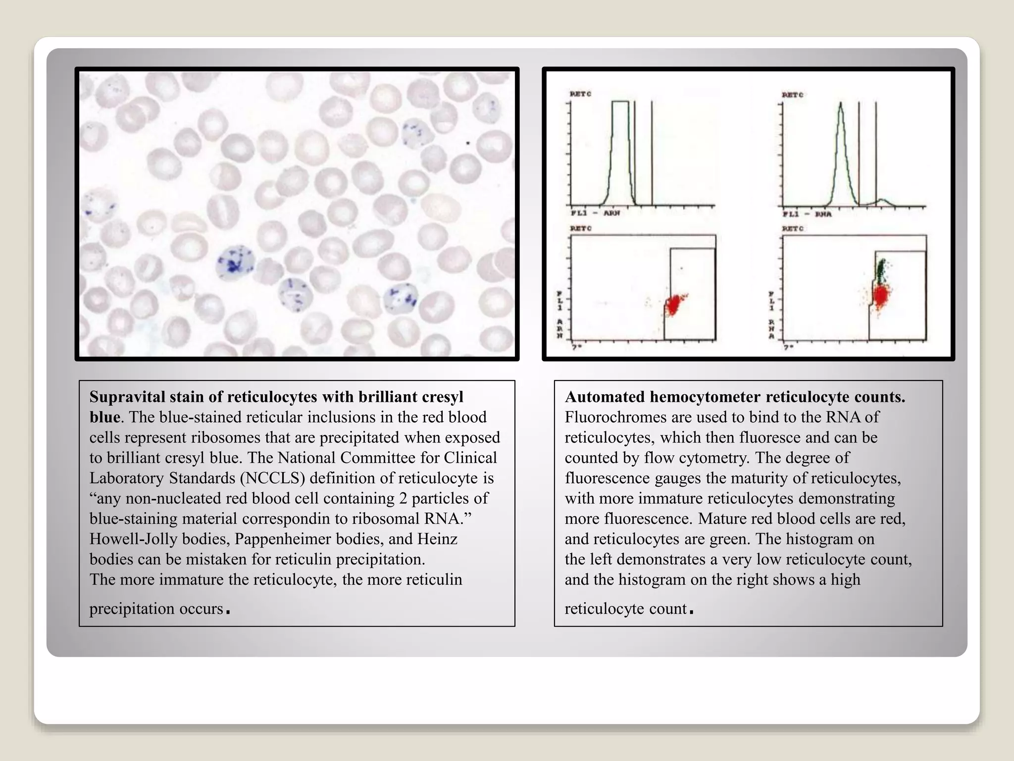 Hemolyic Anemia ppt | PPTX