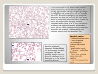 Hemolyic Anemia ppt | PPTX