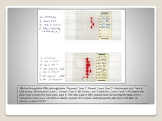 Hemolyic Anemia ppt | PPTX