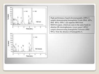 Hemolyic Anemia ppt | PPTX