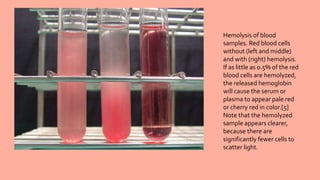Hemolysis | PPTX