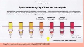 Hemolysis | PPT