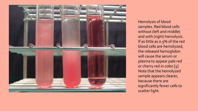Hemolysis | PPT