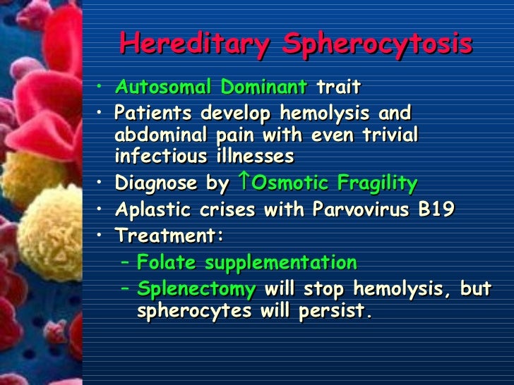 Hereditary Spherocytosis Causes Symptoms Treatment