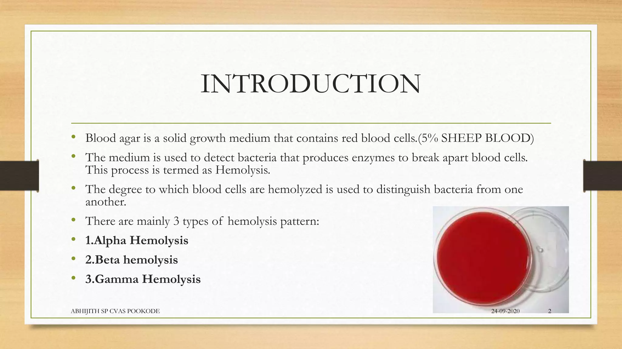 Hemolysis & blood agar abhijith | PPTX