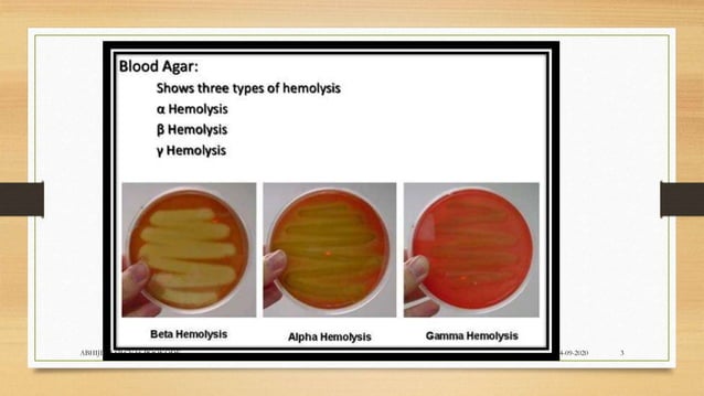 Hemolysis & blood agar abhijith | PPTX