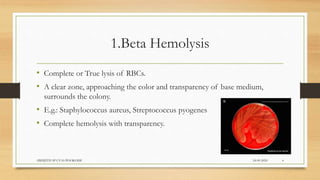 Hemolysis & blood agar abhijith | PPTX