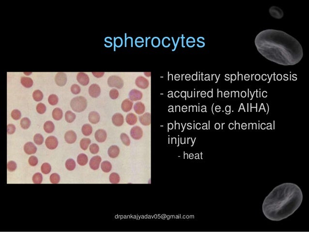Hemolytic anemia