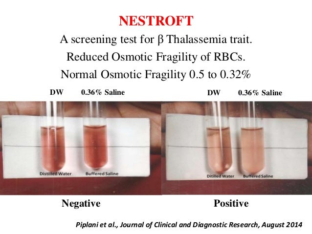 Pathogenesis & Lab diagnosis of Hemolytic Anemia