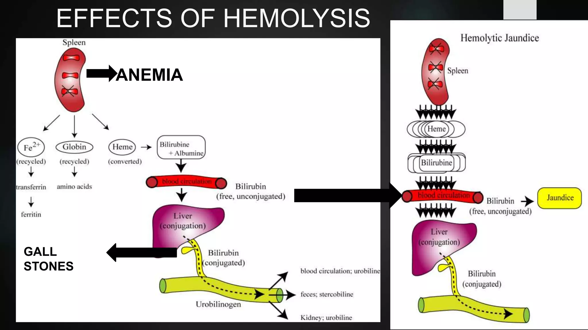 Hemolytic anemia | PPTX