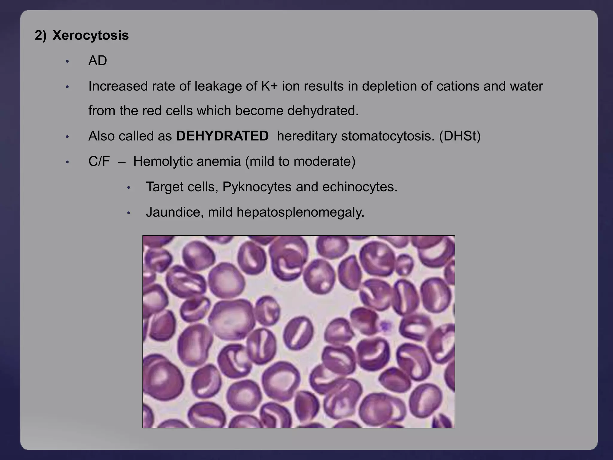 Hemolytic Anemia and it's Classificaiton | PPTX