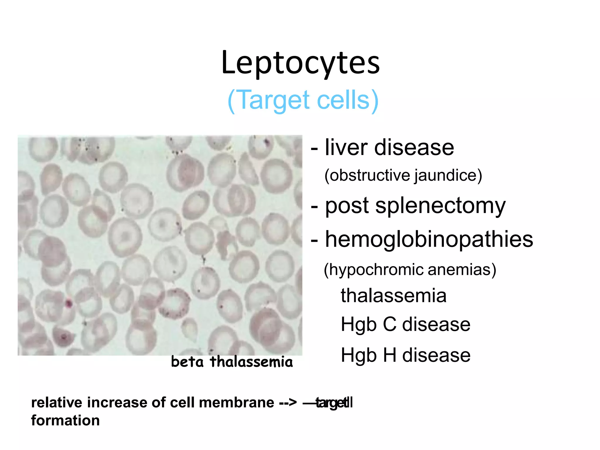 Hemolytic anemia - Approach and Management | PPTX