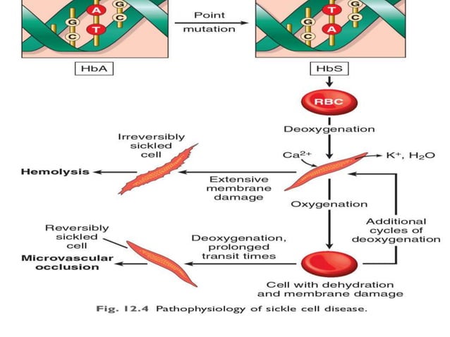 Hemolytic anemia - Approach and Management | PPTX