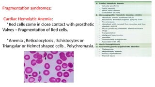 Hemolytic Anemia -Screening and specific test.pptx