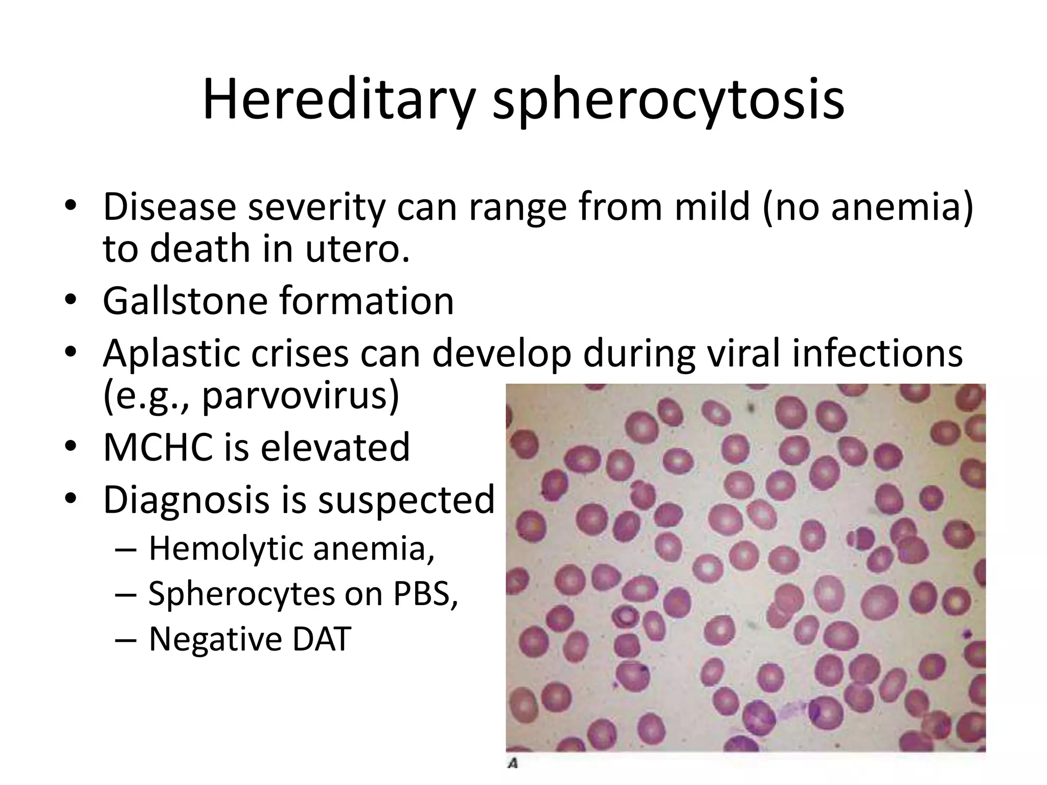 Hemolytic anemia case | PPTX
