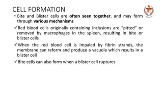 Hemolytic anemia class 31 december.pptx
