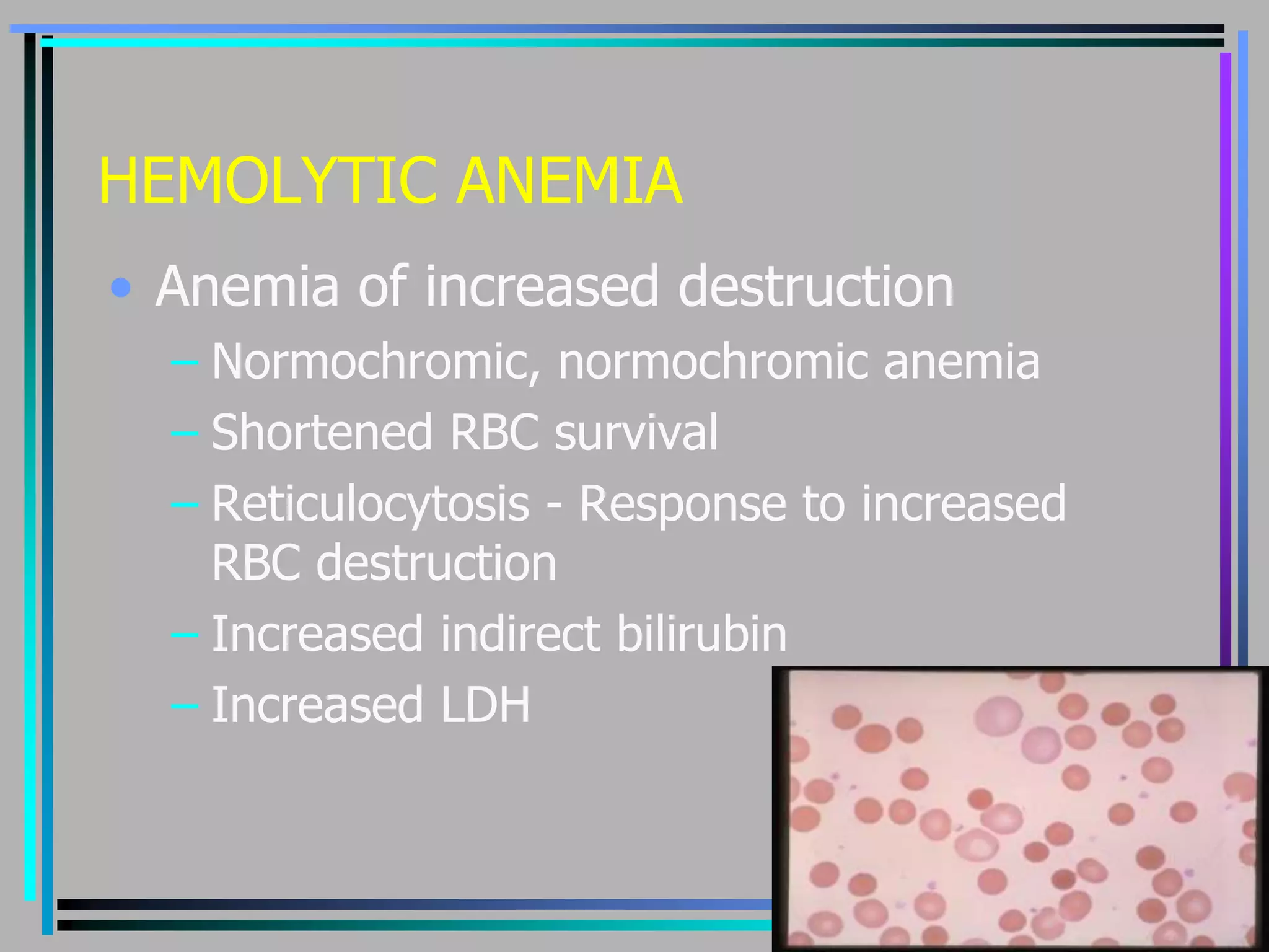 Hemolytic Anemia dr hayder.ppt | Blood Disorders | Diseases and Conditions