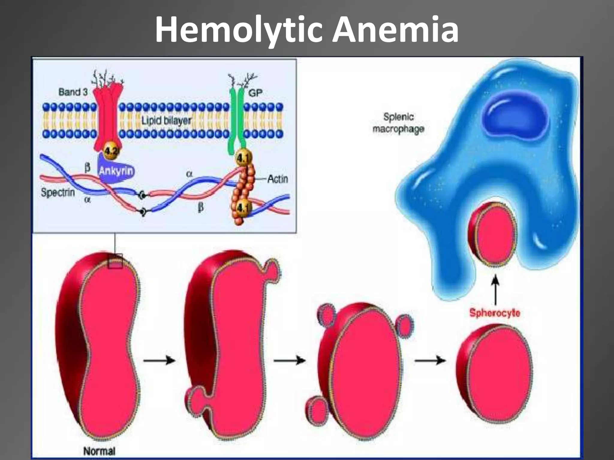 Hemolytic anemia I | PPTX