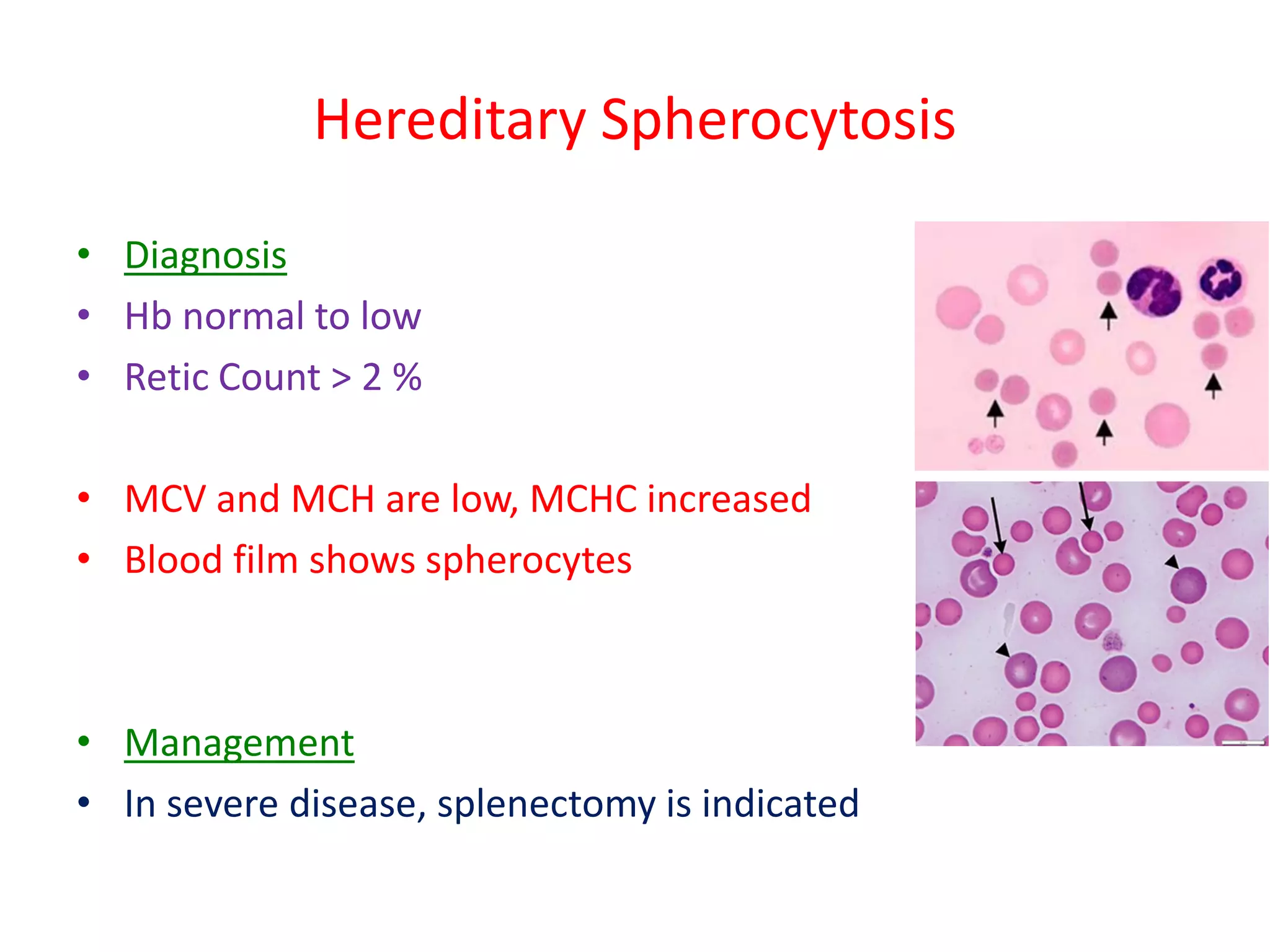 Hemolytic anemia in children 2021 | PDF