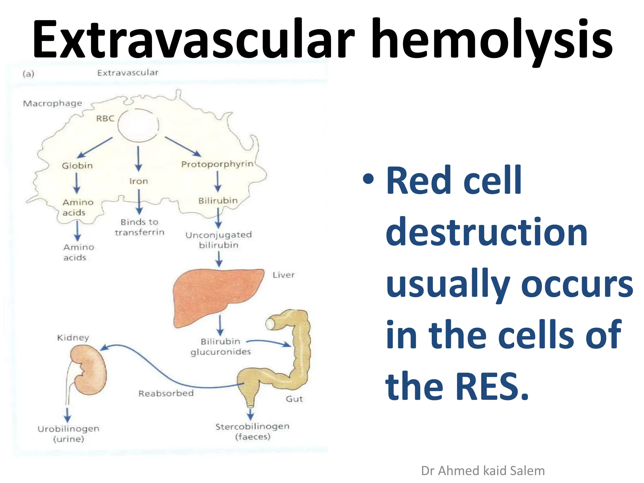 Hemolytic Anemias DDDDDDAIHA 2024 EU.ppt
