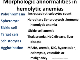 Hemolytic Anemias DDDDDDAIHA 2024 EU.ppt