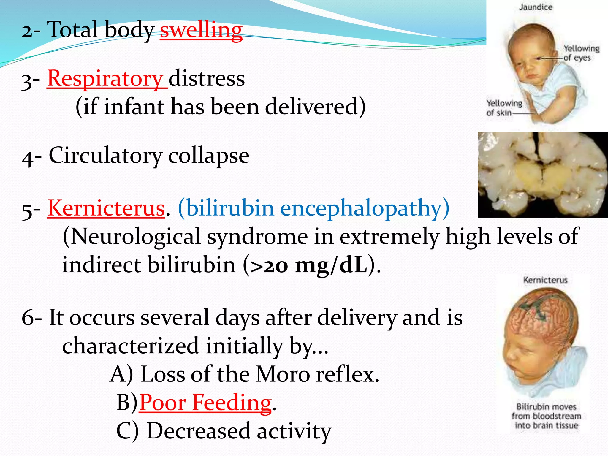 Hemolytic disease of newborn Lecture Final Year MBBS | PPTX