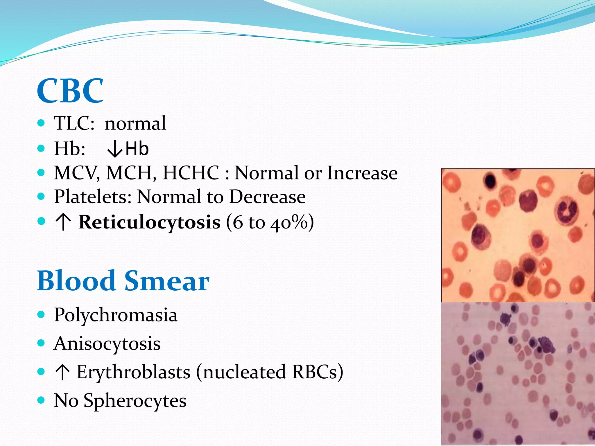 Hemolytic disease of newborn Lecture Final Year MBBS | PPTX