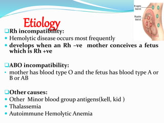 Hemolytic disease of newborn Lecture Final Year MBBS | PPTX