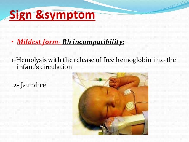 Hemolytic disease of newborn Lecture Final Year MBBS
