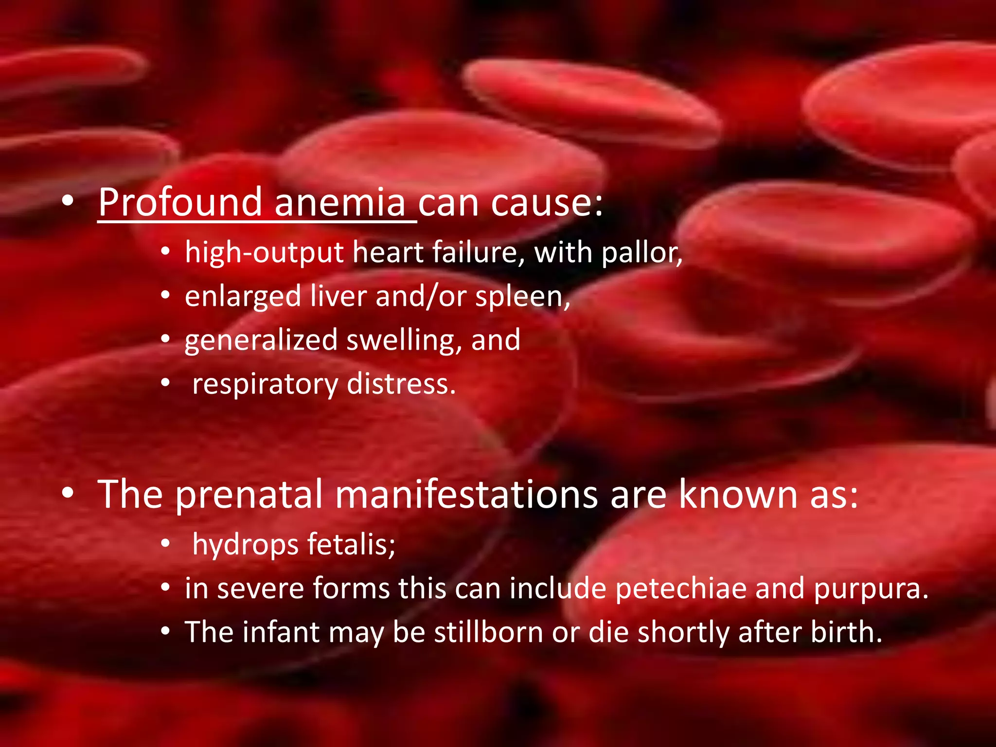 Hemolytic disease of the newborn | PPTX