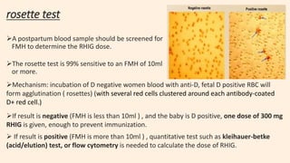 Hemolytic disease of the newborn and neonatal transfusion.pptx