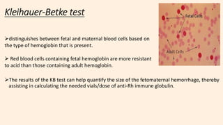 Hemolytic disease of the newborn and neonatal transfusion.pptx