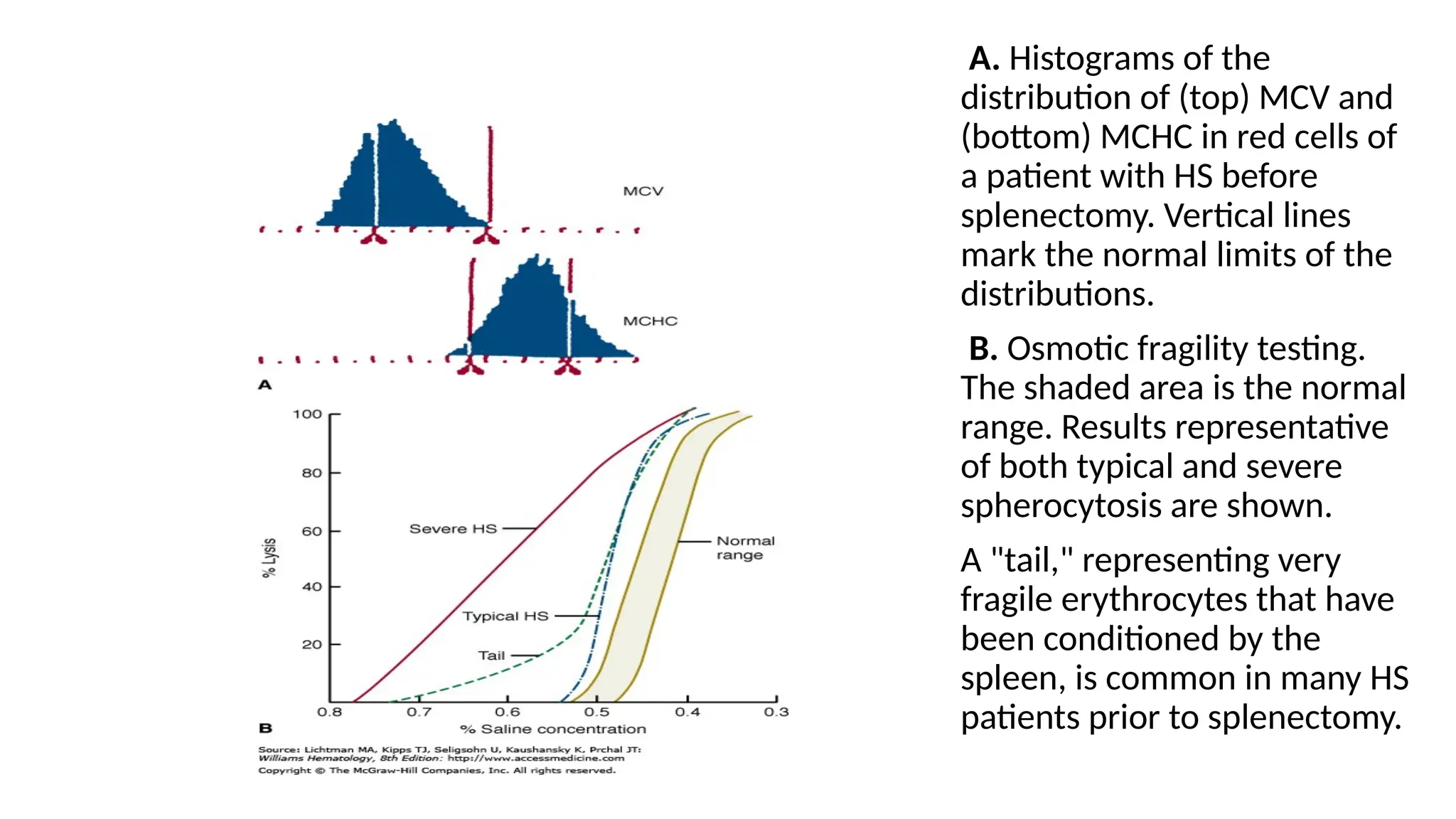 Hemolytic disorders due to Inherited abnormalities in Red cell ...