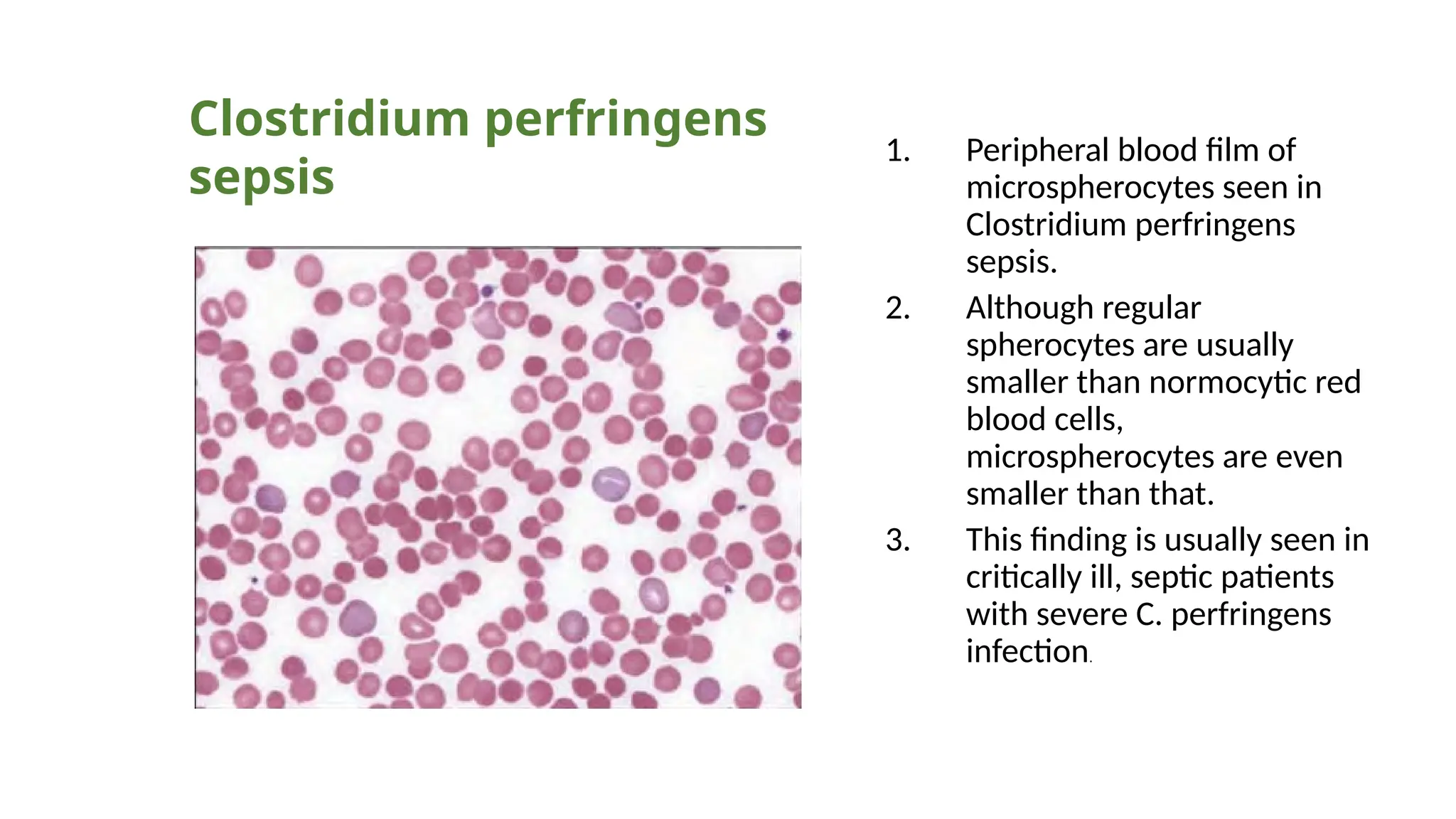 Hemolytic disorders due to Inherited abnormalities in Red cell ...