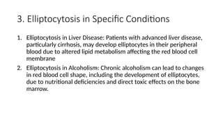 Hemolytic disorders due to Inherited abnormalities in Red cell ...