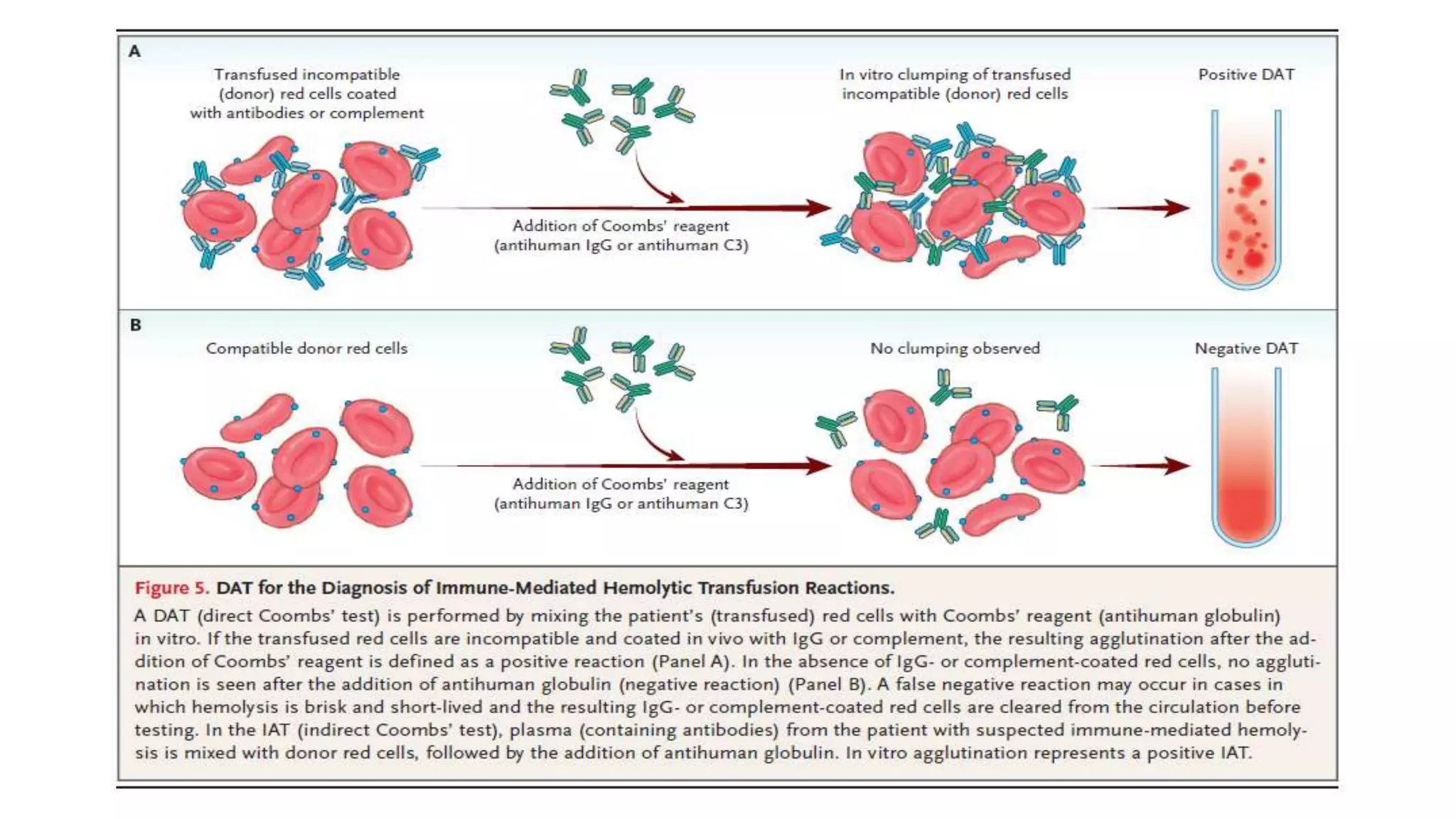 Hemolytic transfusion reaction | PPTX