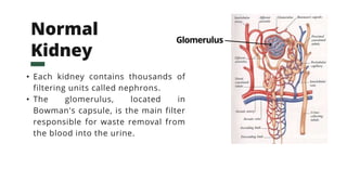 Hemolytic Uremic Syndrome (HUS) (1).pptx