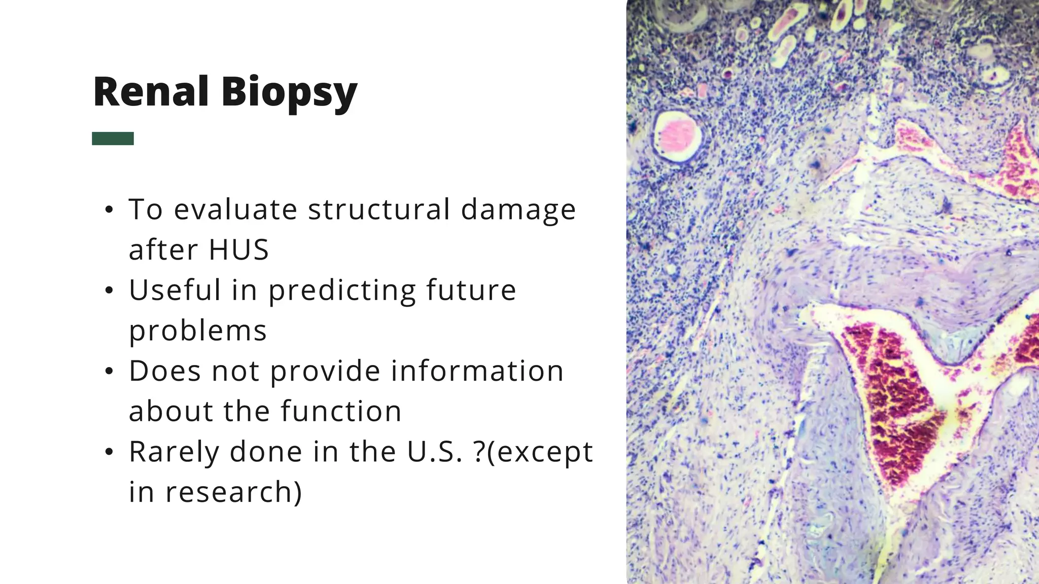 Hemolytic Uremic Syndrome (HUS) chris edits 7.31.23.pptx