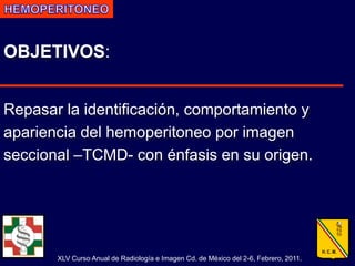 Hemoperitoneo | PDF