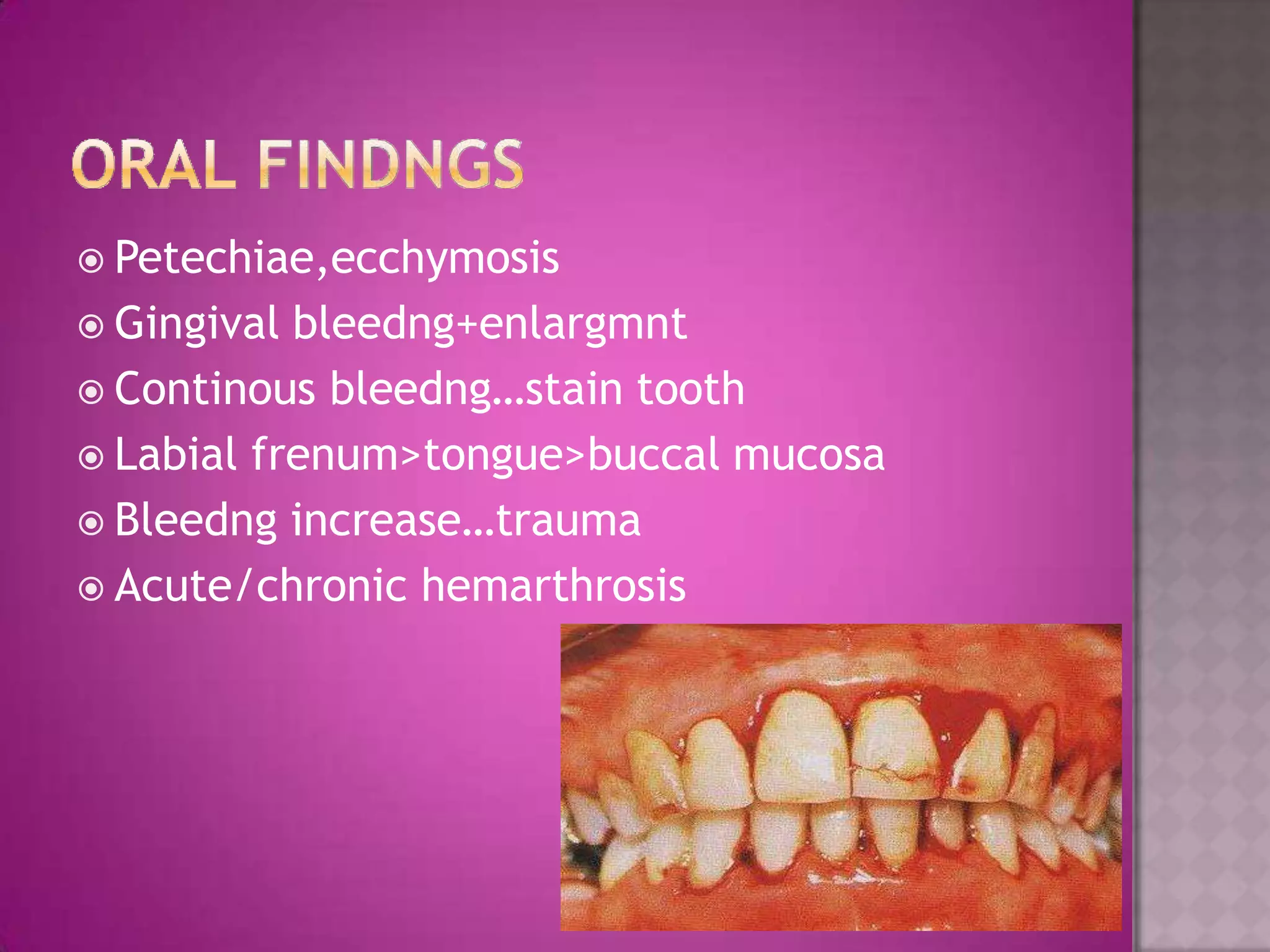 hemophilia-090722123053-phpapp02.pptx