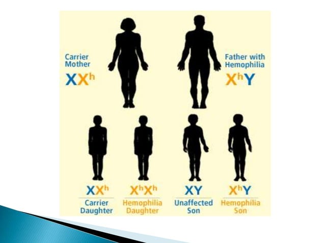 genetic basis of hemophilia | PPTX | Reproductive Health | Diseases and ...