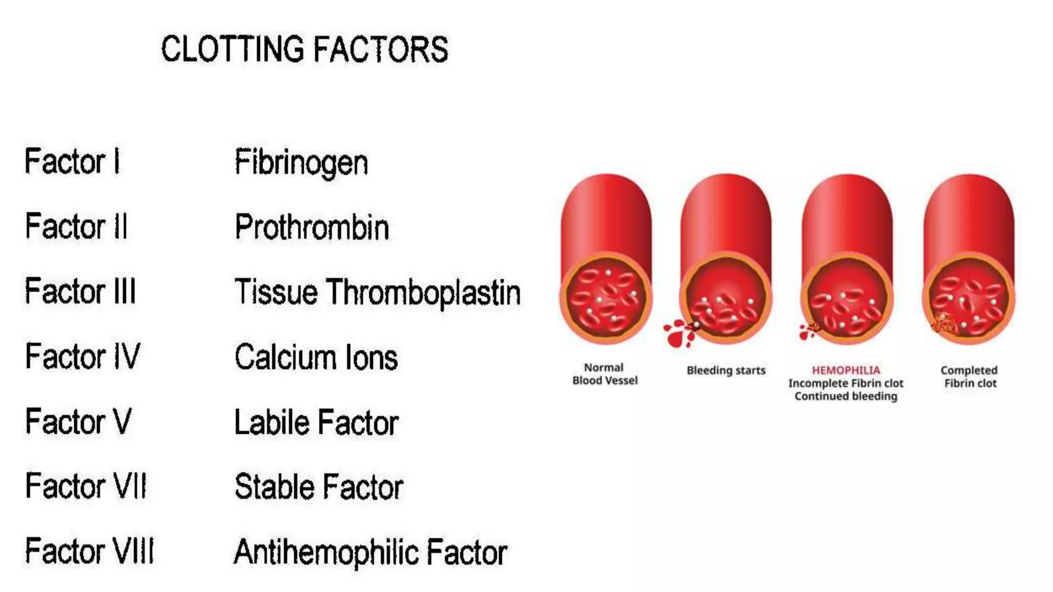 Hemophilia | PPTX