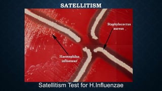 Hemophilus influenzae by Dr. Rakesh Prasad Sah | PPTX