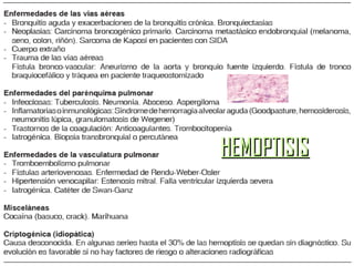 Hemoptisis | PPT